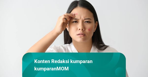 Ciri-Ciri Orang Hamil dari Raut Wajah, Kenali Perubahannya | kumparan.com